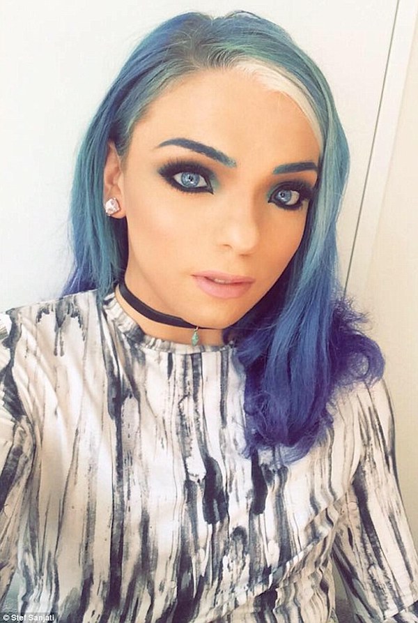 Waardenburg Syndrome Meet 5 People With The Rare Genetic Mutation