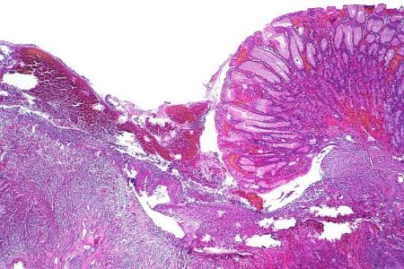 10 Incredible Stories of Melting - "melting," "incredible," "global ...