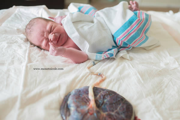 10 Powerful Placenta Photos - Oddee