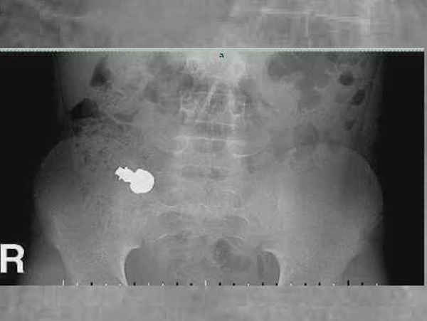 10 Unbelievable Snowman Stories - Oddee