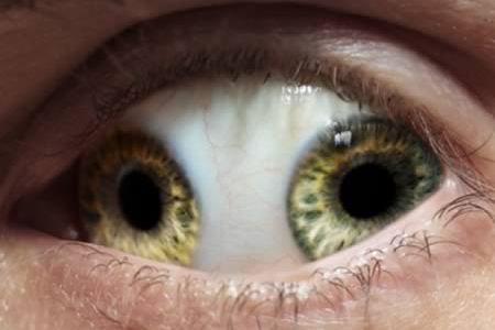 10 Most Bizarre Eyes - weird eyes, pupula duplex - Oddee