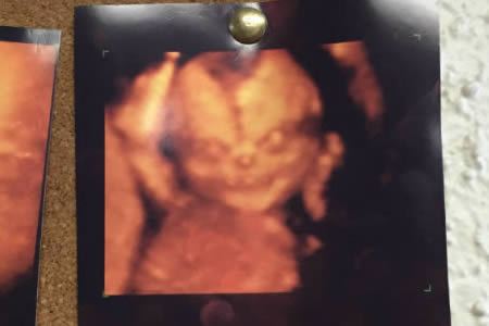 Another 10 Amazing Ultrasound Photos - Oddee