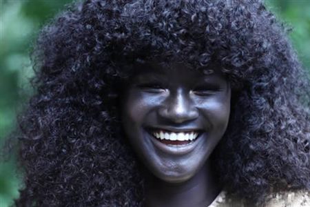 7 Gorgeous People with Unique Skin Color - Oddee